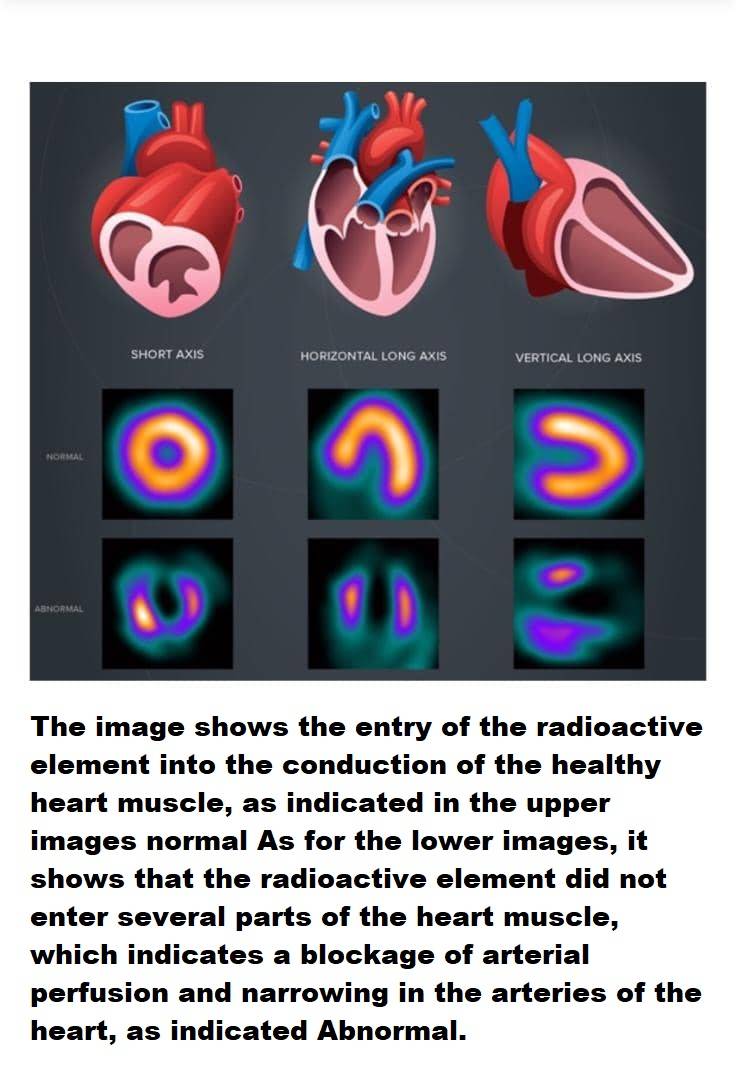 Types of imaging modalities for cardiology in Iran | Best Surgeons