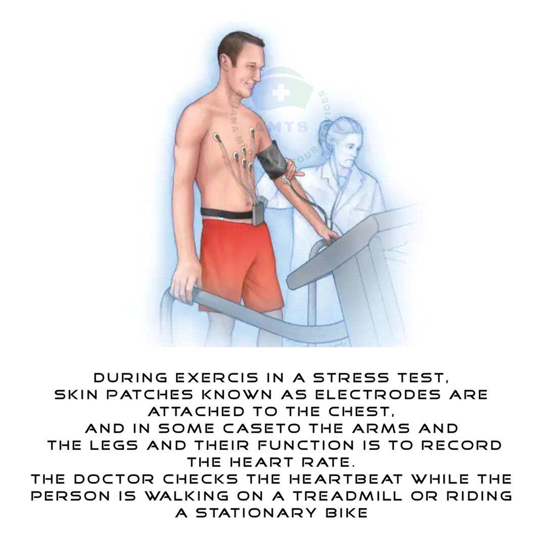 Types of imaging modalities for cardiology in Iran | Best Surgeons